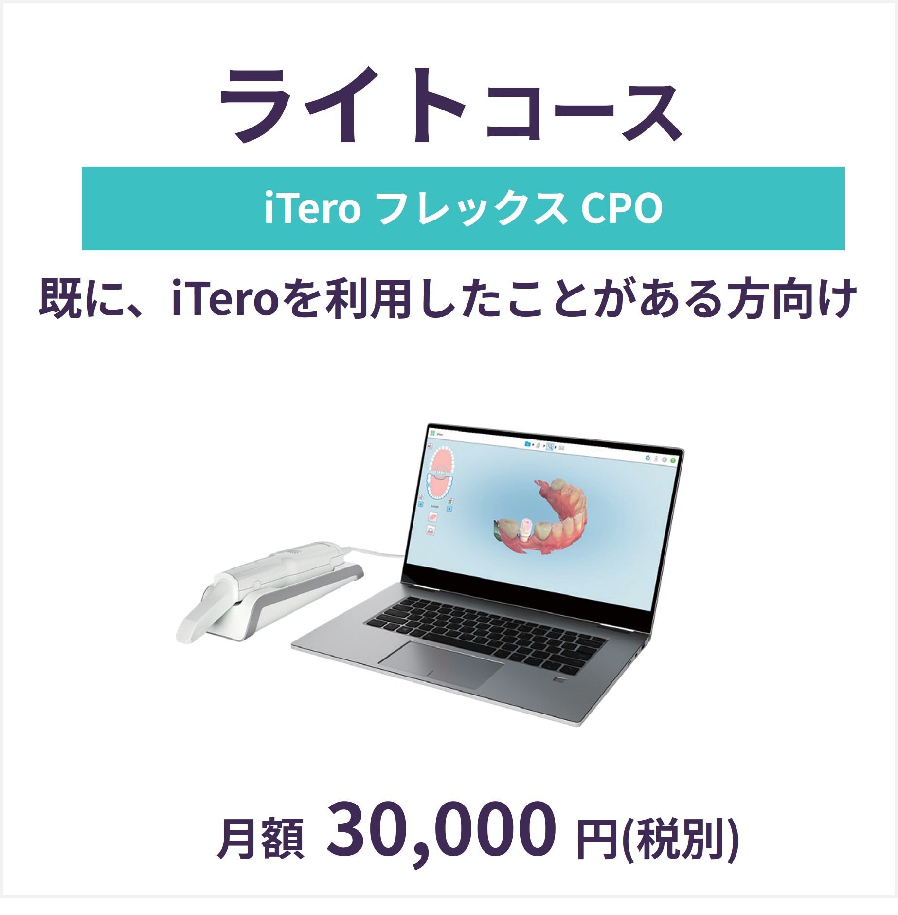 iTero の3カ月レンタル Go Digital